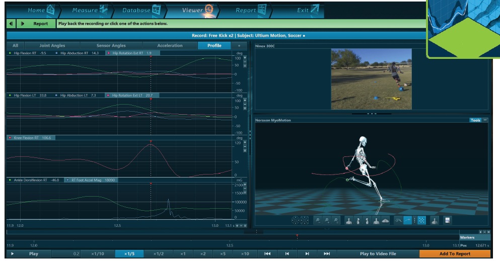 Ultium Motion, Portable 3D Motion Capture System - Wireless IMU System Ultium Motion, Portable 3D Motion Capture System - Wireless IMU System